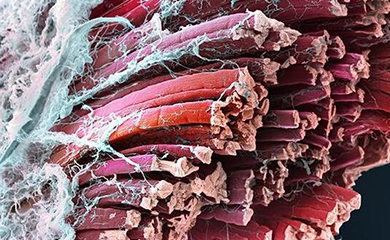 Qué es la fascia y cuáles son sus funciones en el organismo | Edison Osorio